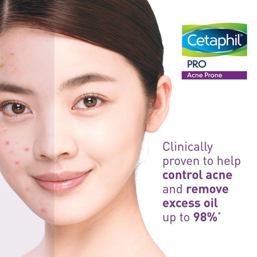 Cetaphil Pro Acne Prone Skin Foam Wash- SahaJamal Pharmacy | Shop ...